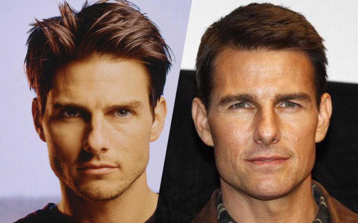 10 celebrities que se retocaron la nariz | Fotogalería | Actualidad | LOS40