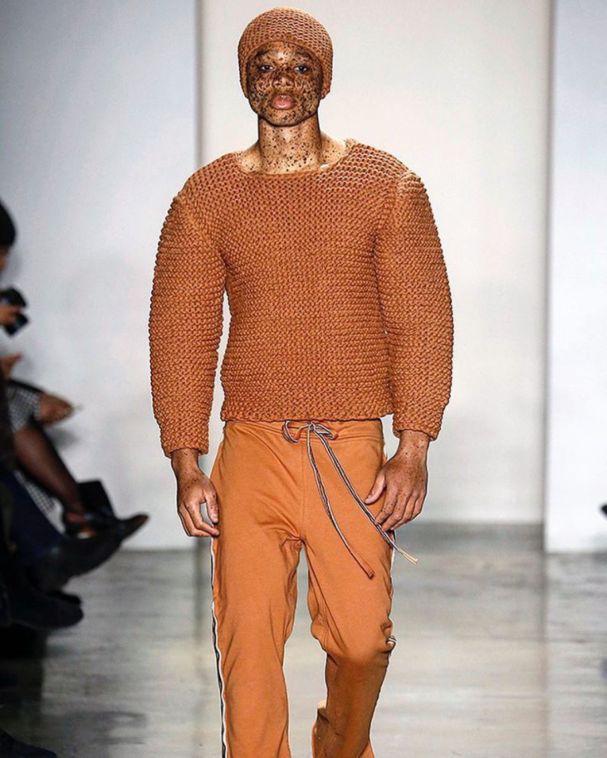 Ralph Souffrant, el modelo que demuestra que las pecas molan ...