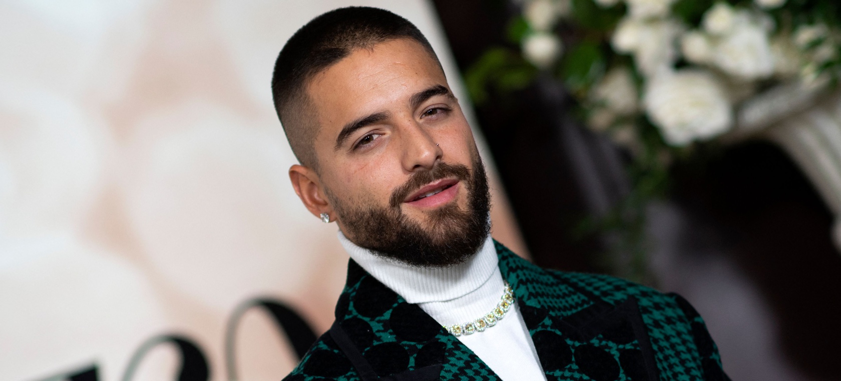 Maluma muestra cómo le ha dejado la cara la mordida de su perro | Big ...
